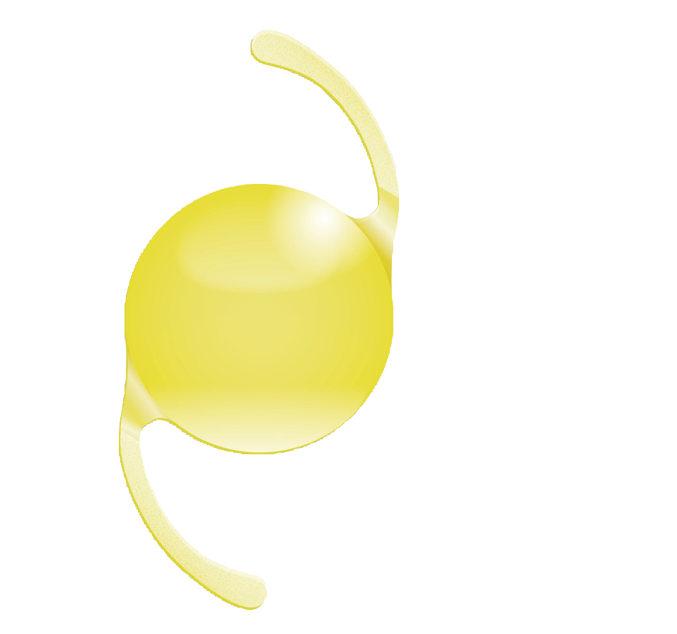 Implantate / IOL | Mediconsult Österreich